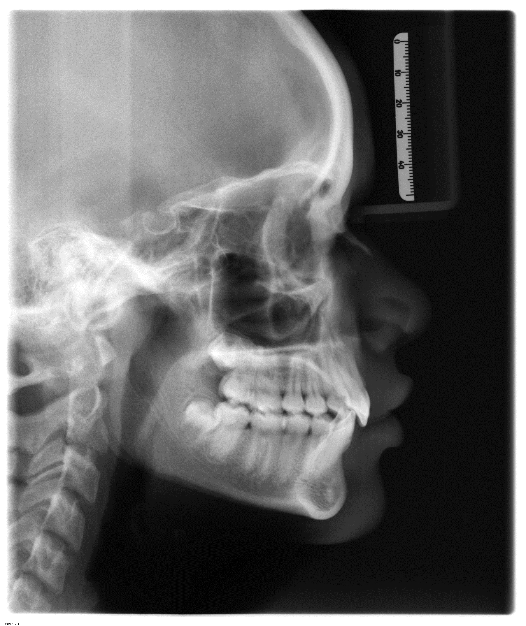 Telerradiografia Lateral - Unimagem